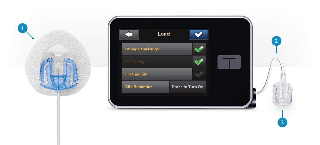 AutoSoft XC Infusion Set, 6mm Cannula, 23” Tubing, T:lock, Grey – DDP ...